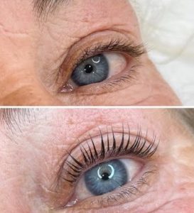 What Is Lash Botox? Complete Guide - Lash Masterclass